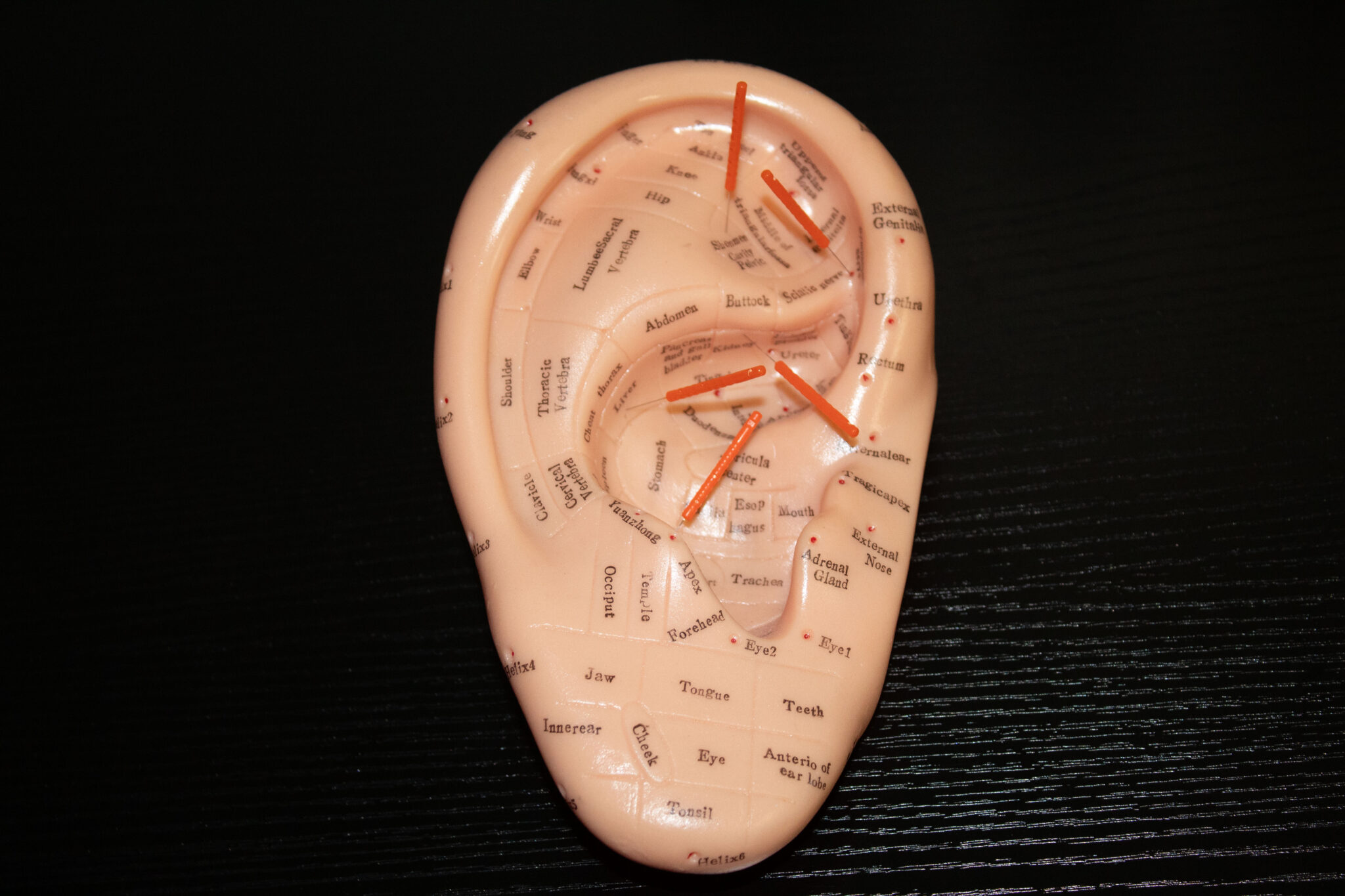 Addicted to Wellness: Discover How Acupuncture Can Support Addiction ...