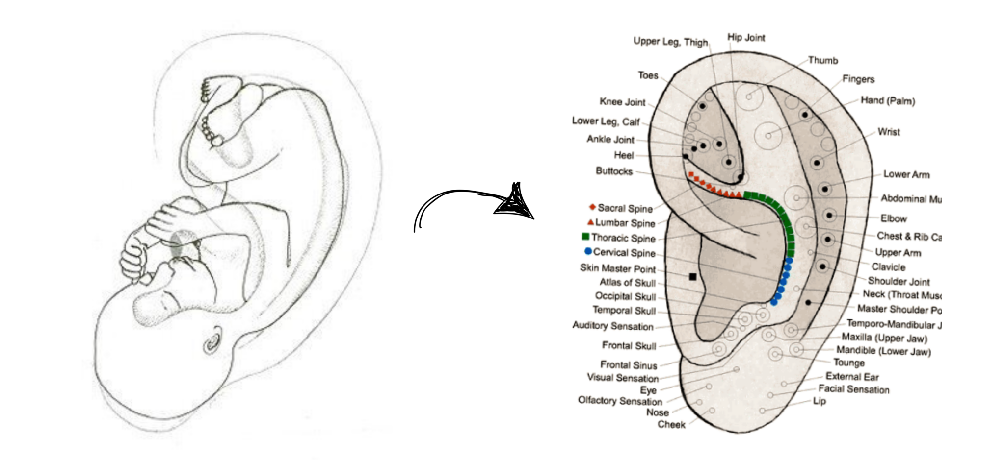 Acupuncture in Midland, MI at Midland Sports Rehab